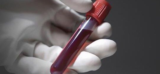 Blærebetændelse og blod - Har du blod i urinen?