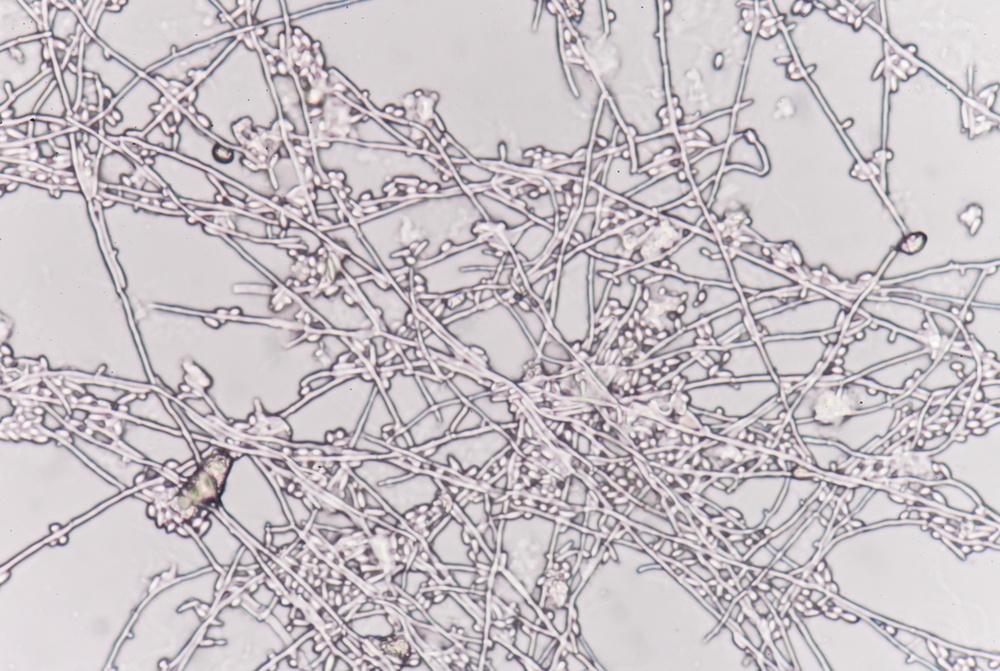 Svamp i navlen - Alt om symptomer og behandling (se video)